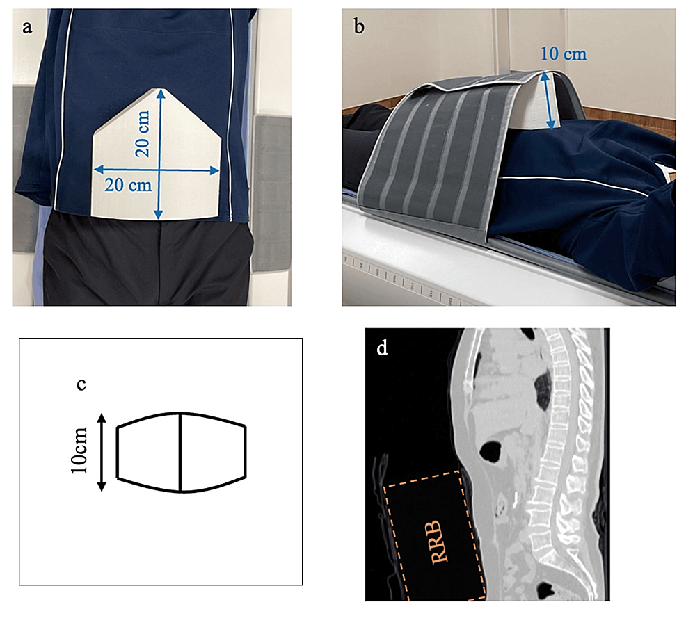 Efficacy of a Novel Respiratory Motion Reduction Block in Reducing ...