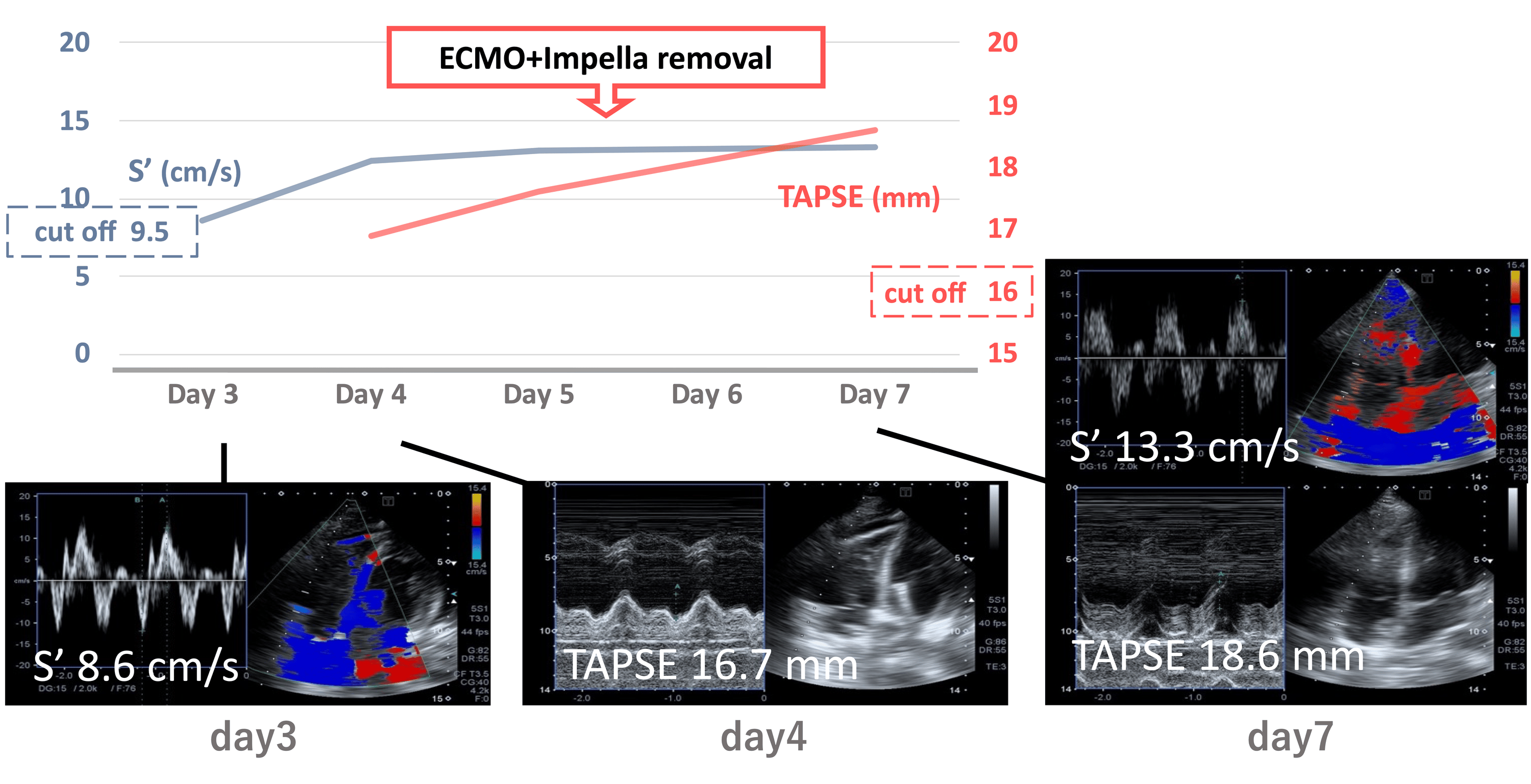 Point-of-Care Ultrasound (POCUS)-Guided Management of Cardiogenic Shock ...