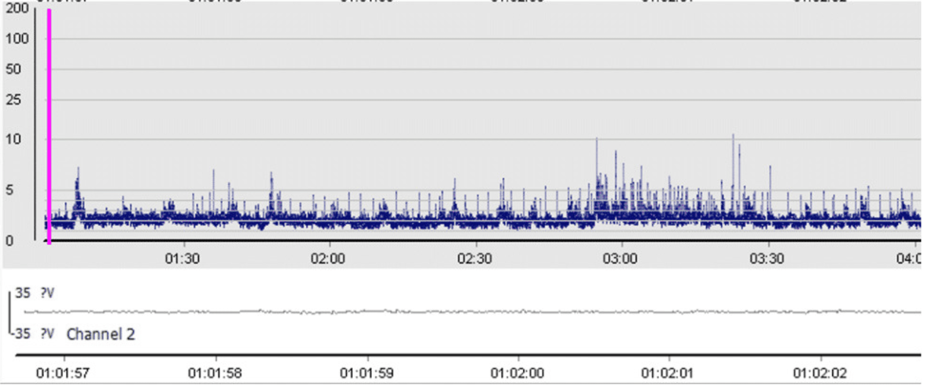 Cureus | Progression of Amplitude-Integrated Electroencephalography and ...