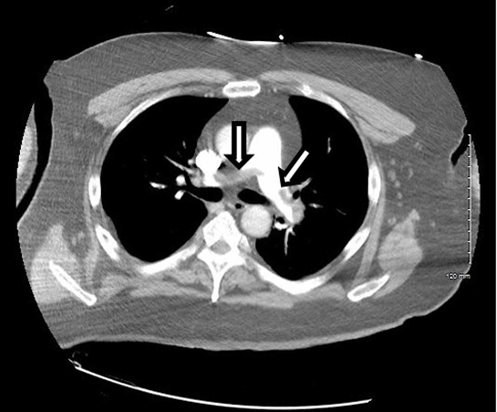 Cureus Serial Point Of Care Echocardiography Performed By An