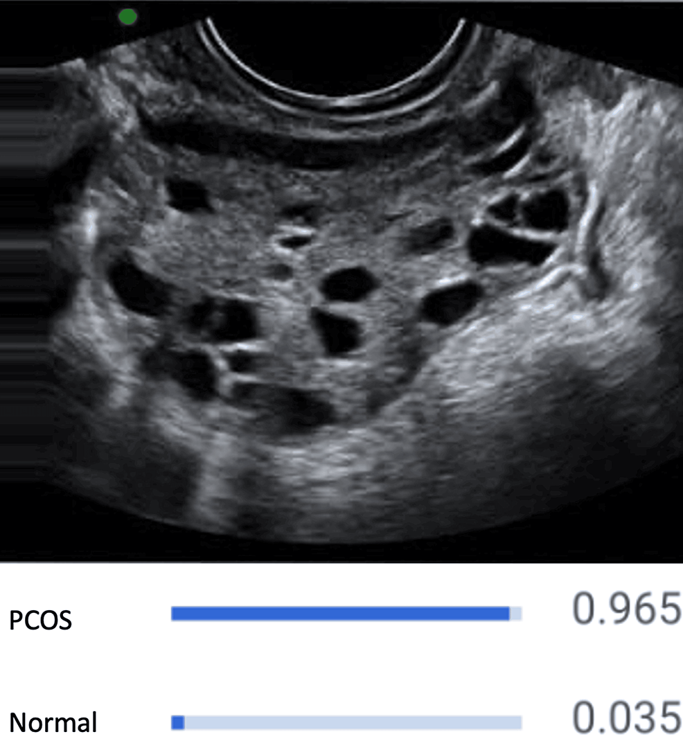 Development of a Machine Learning-Based Model for Accurate Detection ...