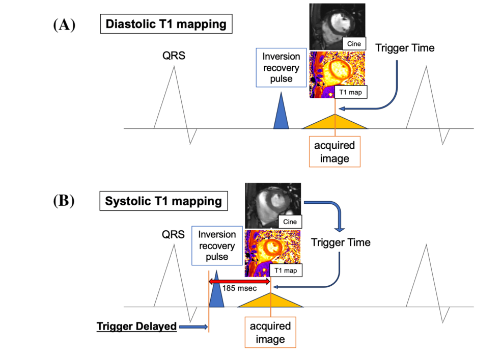 Evaluation of Right Ventricular Myocardial Properties Using Systolic ...