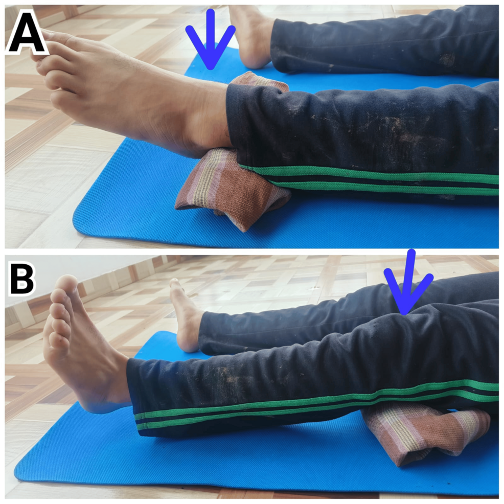 Reviving Movement and Stability: A Case Series on Different Innovative ...