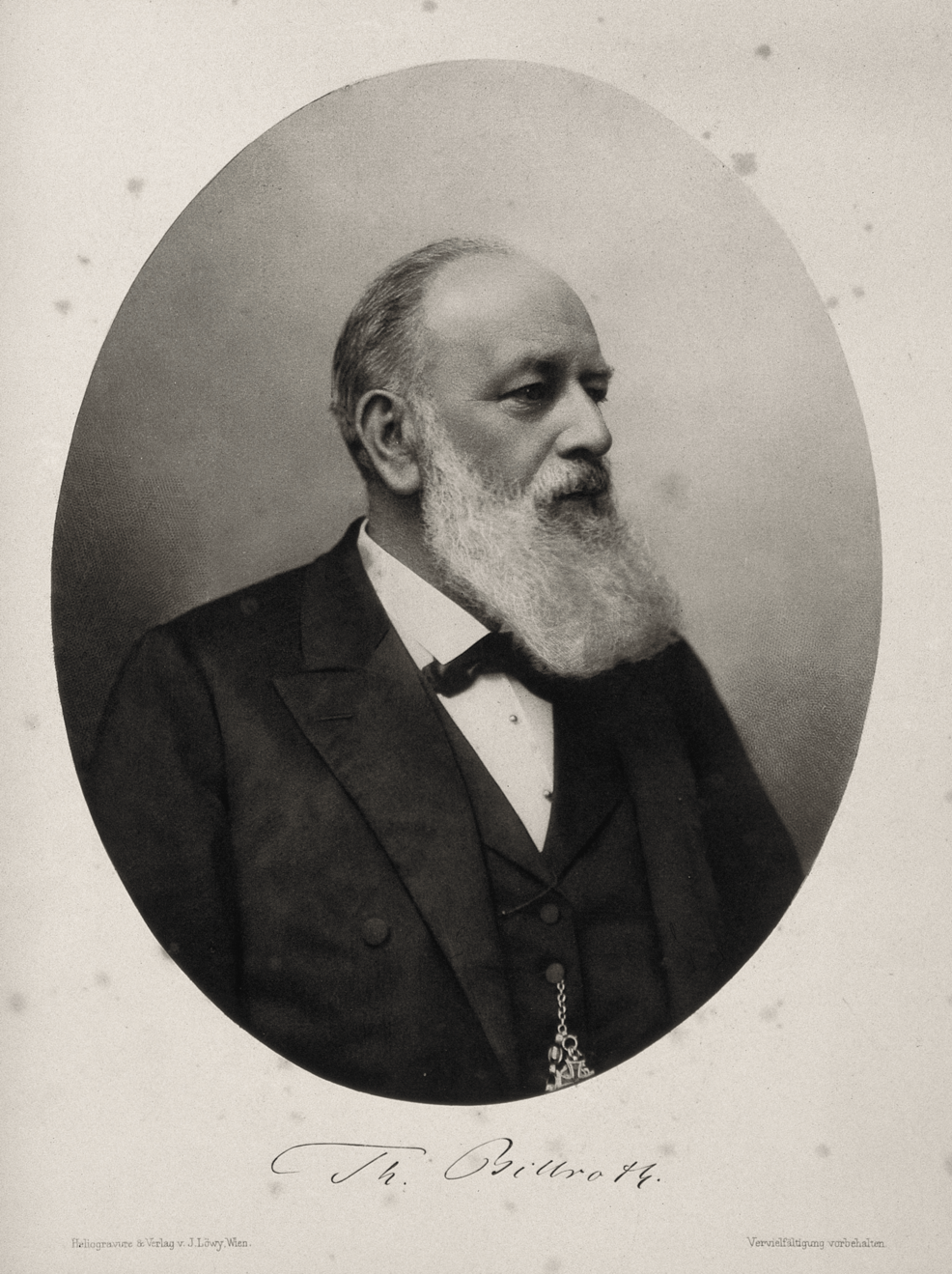 polya reconstruction