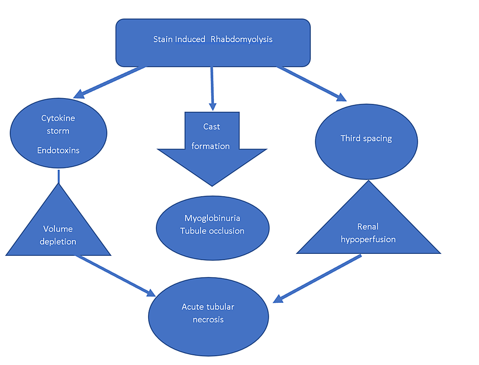 Clinical Rhabdomyolysis With Acute Kidney Injury Secondary to High ...