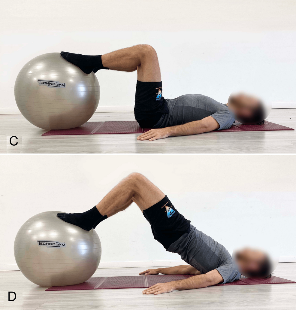 Supine Bridge Exercise: A Narrative Review of the Literature (Part I ...
