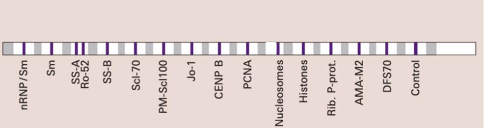 Assessment of the Impact of Anti-nuclear Antibody (ANA) Titer and ...
