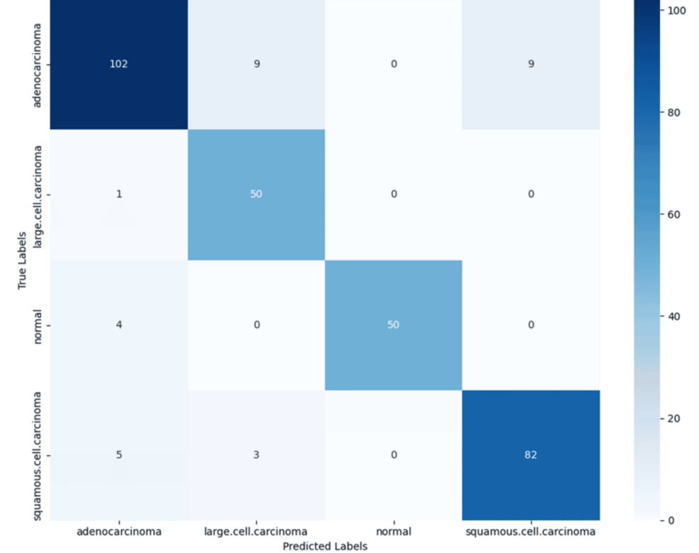 Leveraging Transfer Learning and Attention Mechanisms for a Computed ...