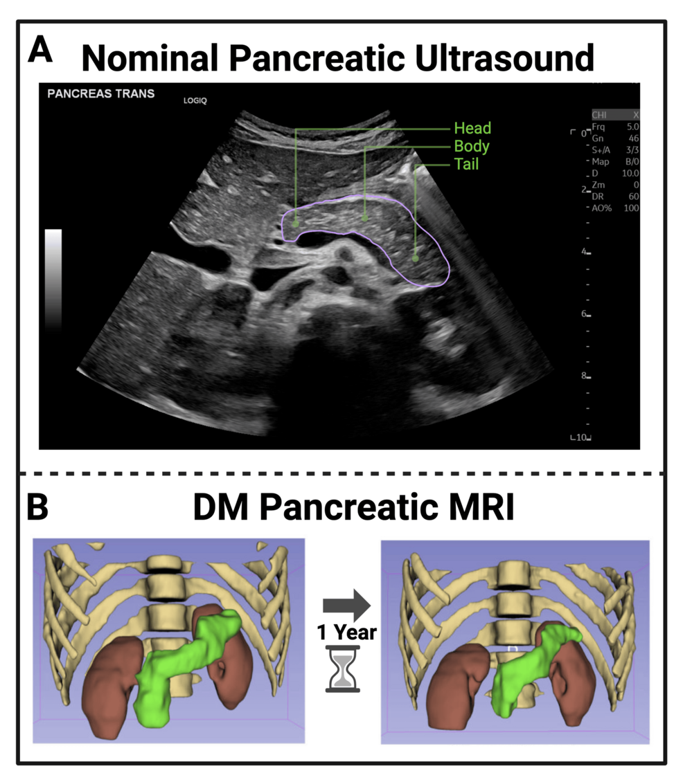 An Ultrasound Imaging Repository of the Pediatric Pancreas ...