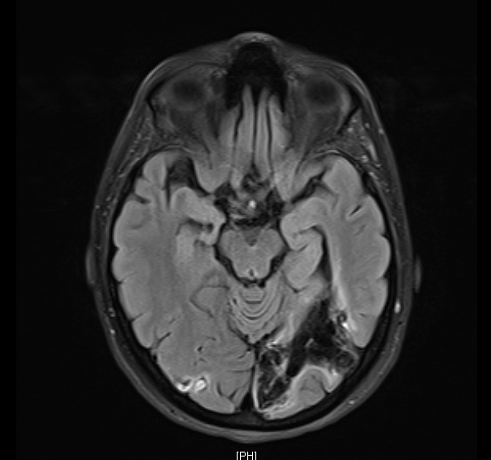 mriup,_大山谷图库