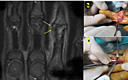 The Accuracy and Cost-Effectiveness of MRI Assessment of Collateral ...