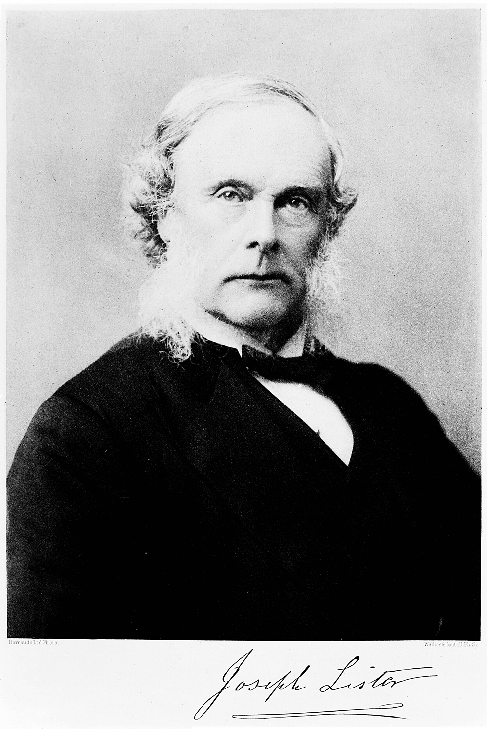 Cureus Joseph Lister 1827 1912 A Pioneer Of Antiseptic Surgery Cureus Joseph Lister 1827 1912 A Pioneer Of Antiseptic Surgery