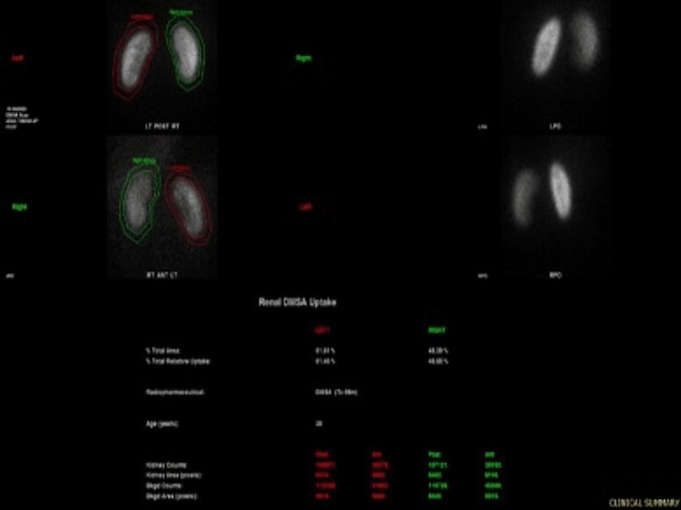 Cureus | A Rare and Late Complication of Subureteric Teflon Injection ...