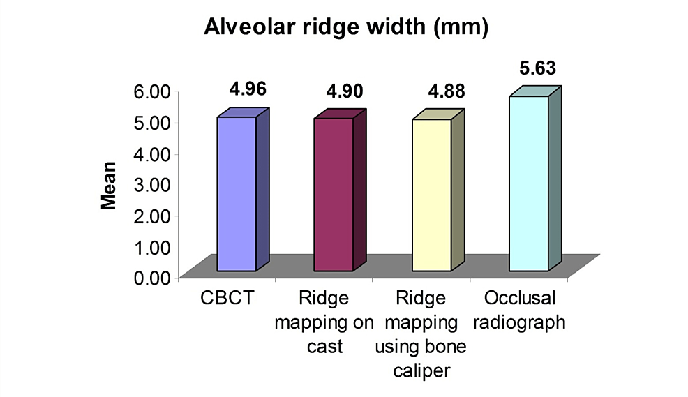 Alveolar Ridge