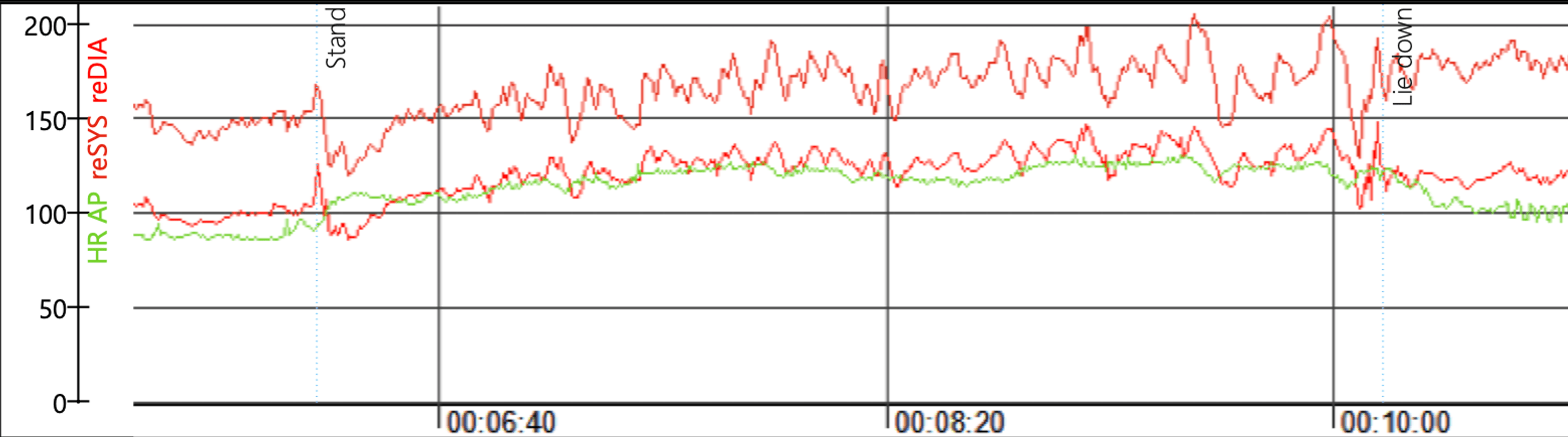 Cureus | Active Stand Testing for Identification of Postural ...