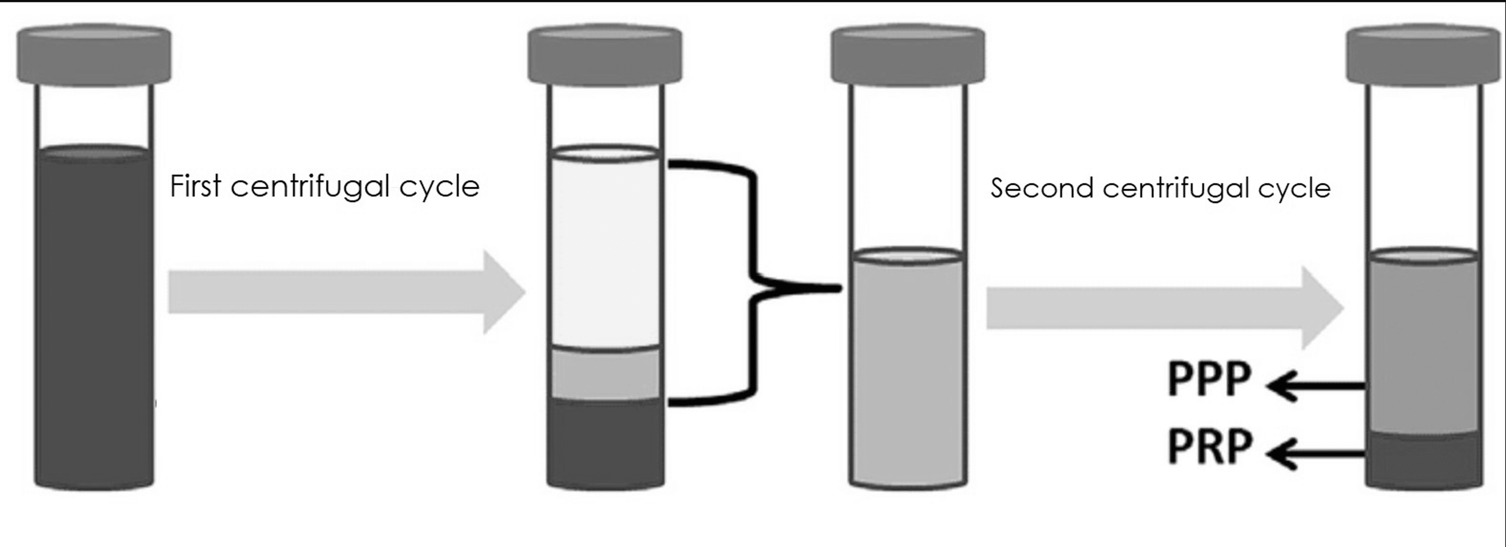 Factors Affecting Platelet-Rich Plasma Success in Patients With ...