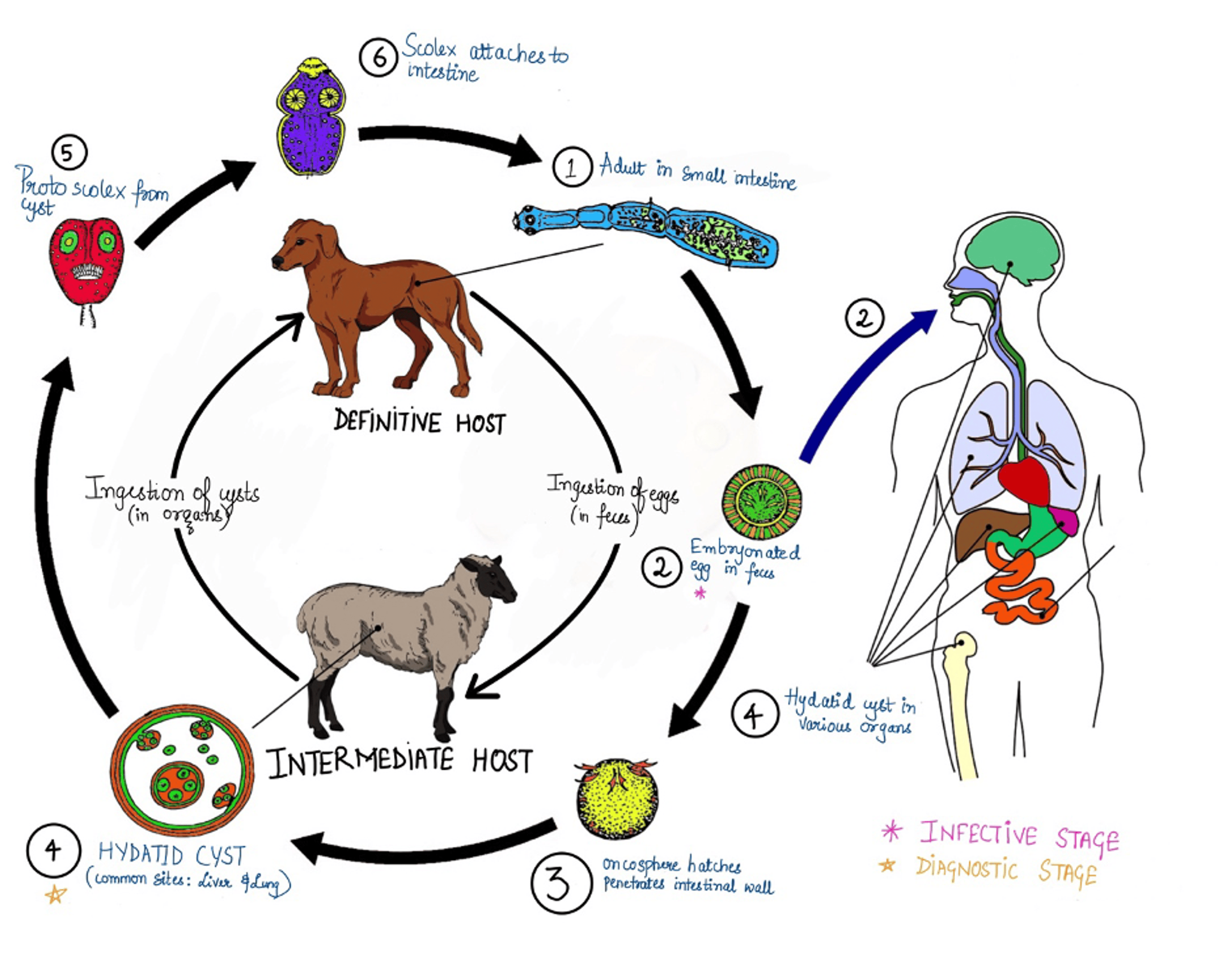 Echinococcal Disease of the Fallopian Tube as a Rare Cause of Primary ...