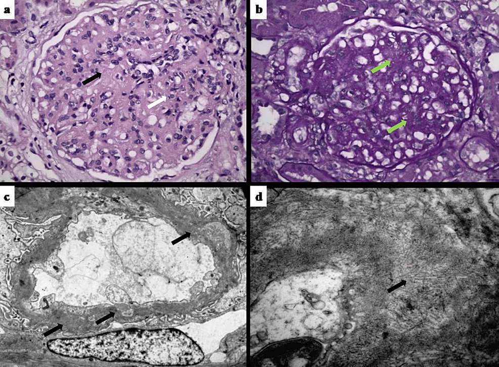 Mesangial Cell Histology