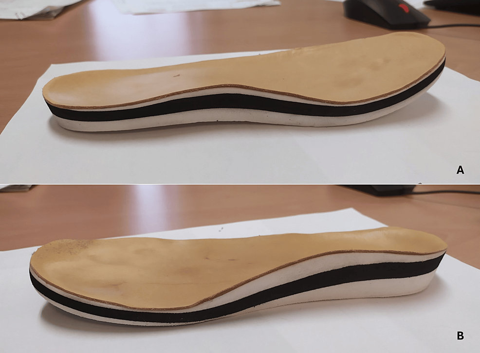 Arthrogryposis Multiplex Congenita and the Importance of Orthoses: A ...