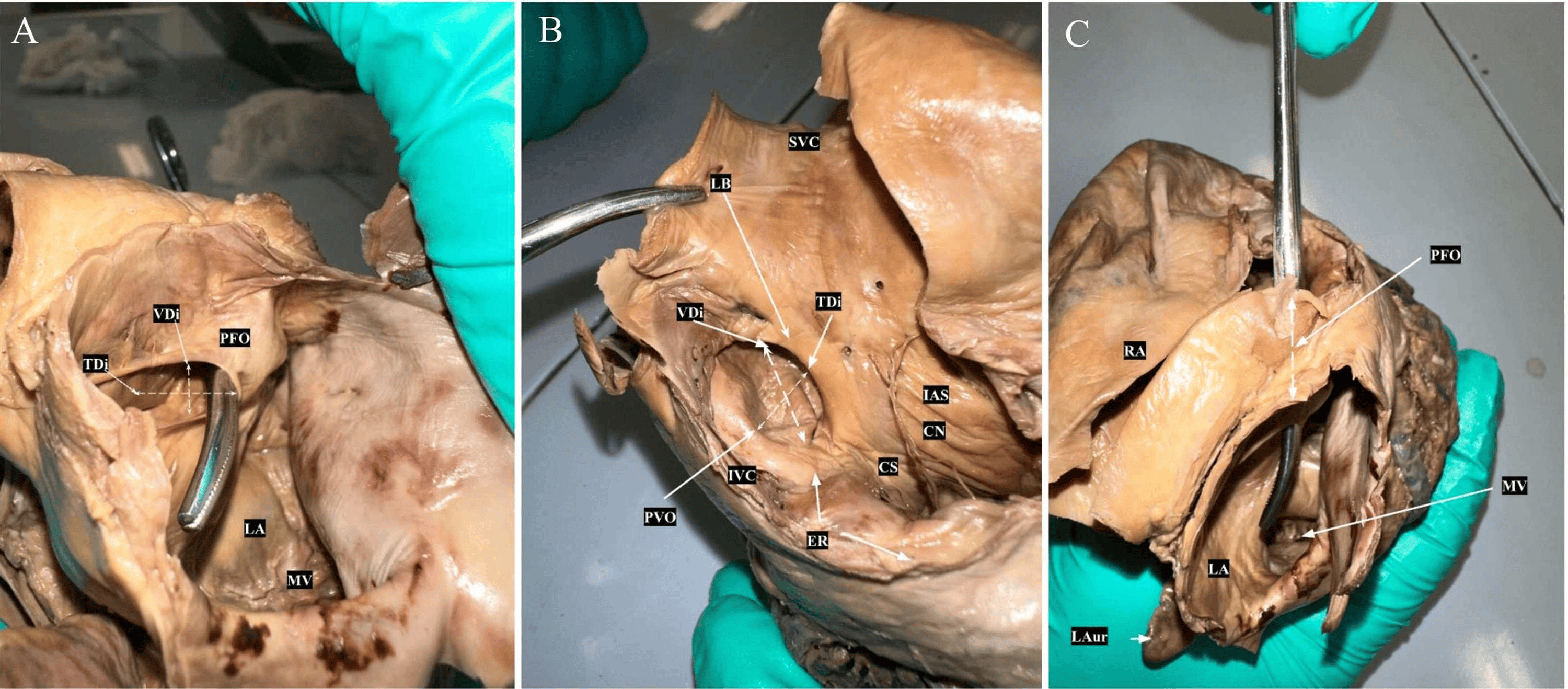 A Triad of Intricacies: An Exploration of Concomitant Codominant ...