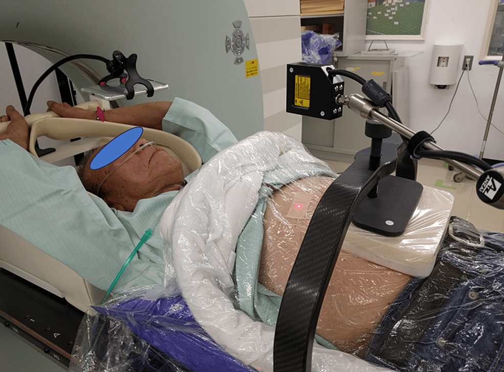 Clinical Implementation and Initial Validation of Respiratory-Gated ...