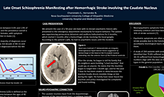 caudate nucleus stroke